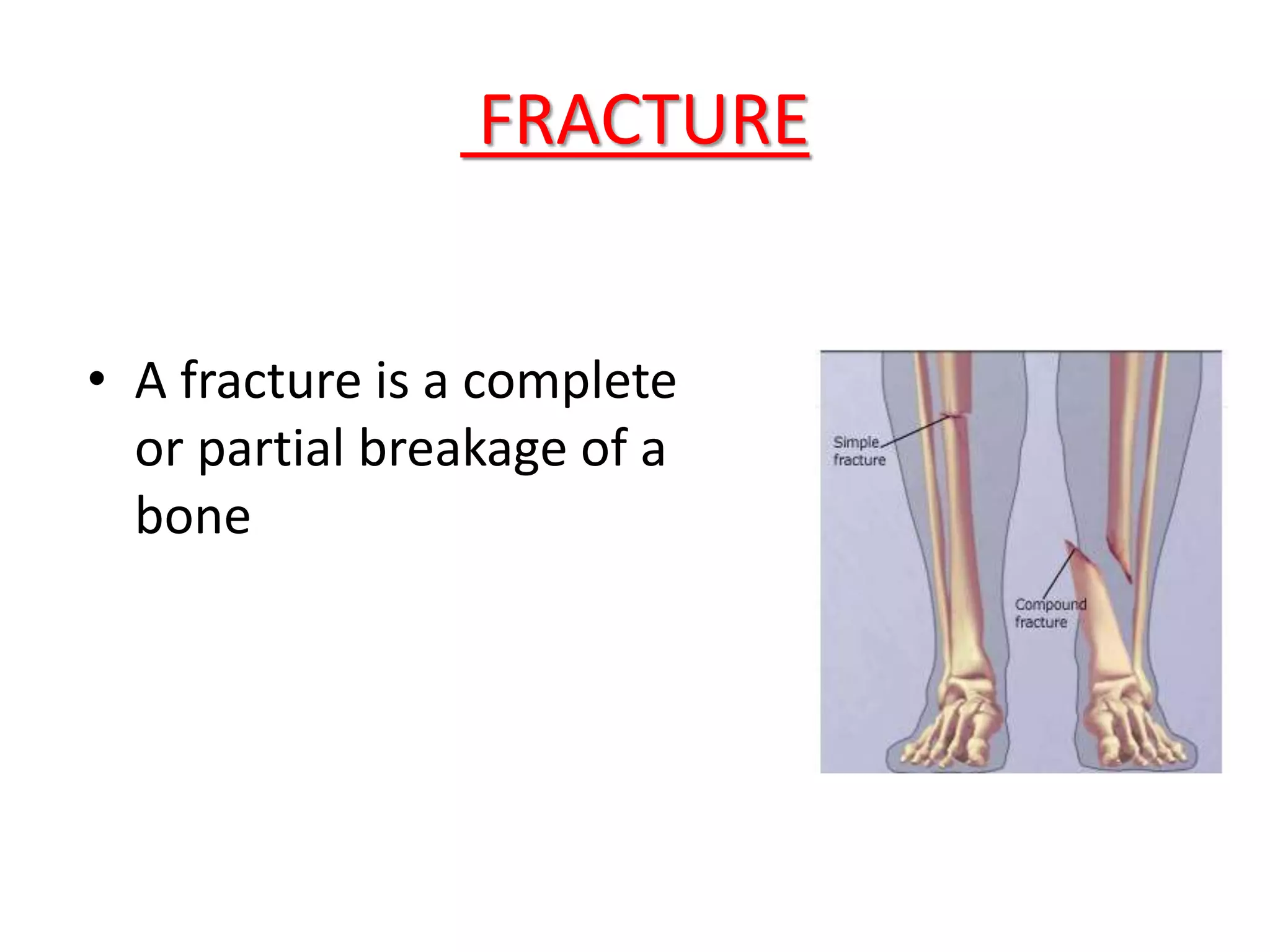First Aid - Trauma.pptx