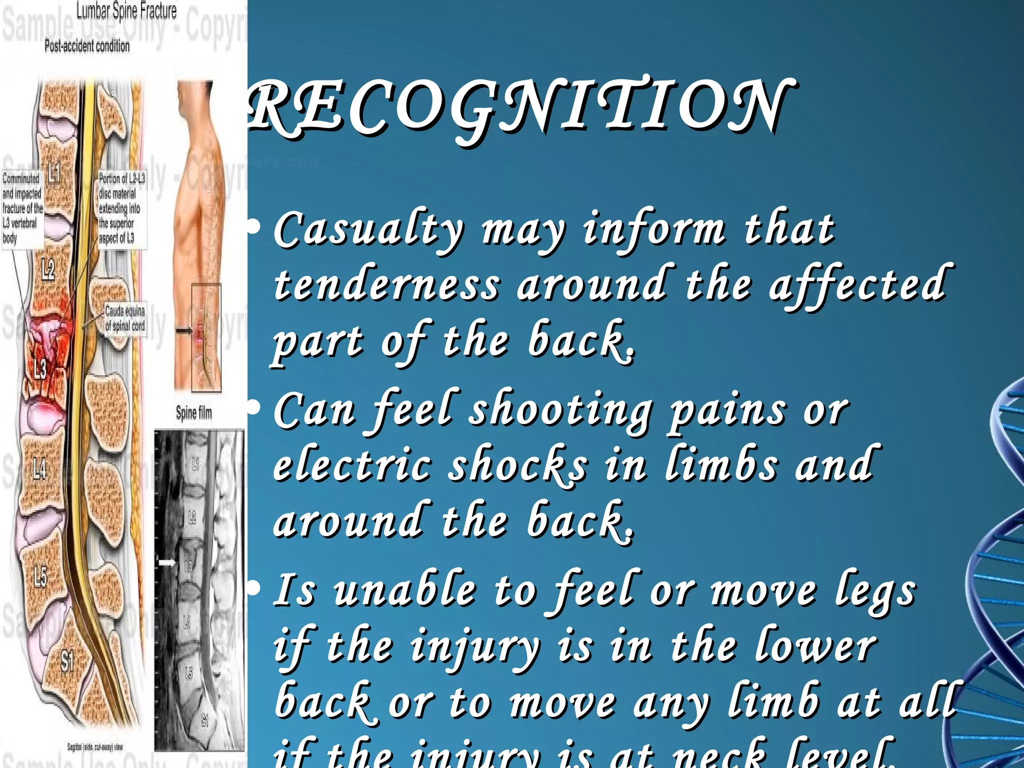 First aid for fracture | PPT