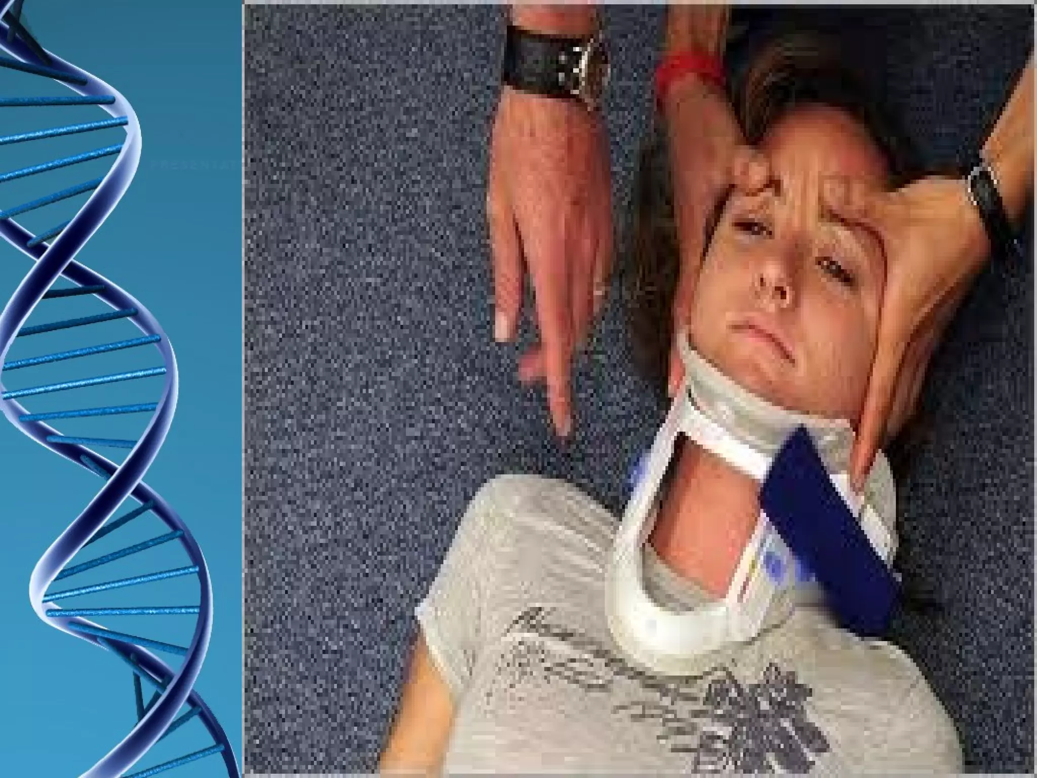 First aid for fracture | PPT