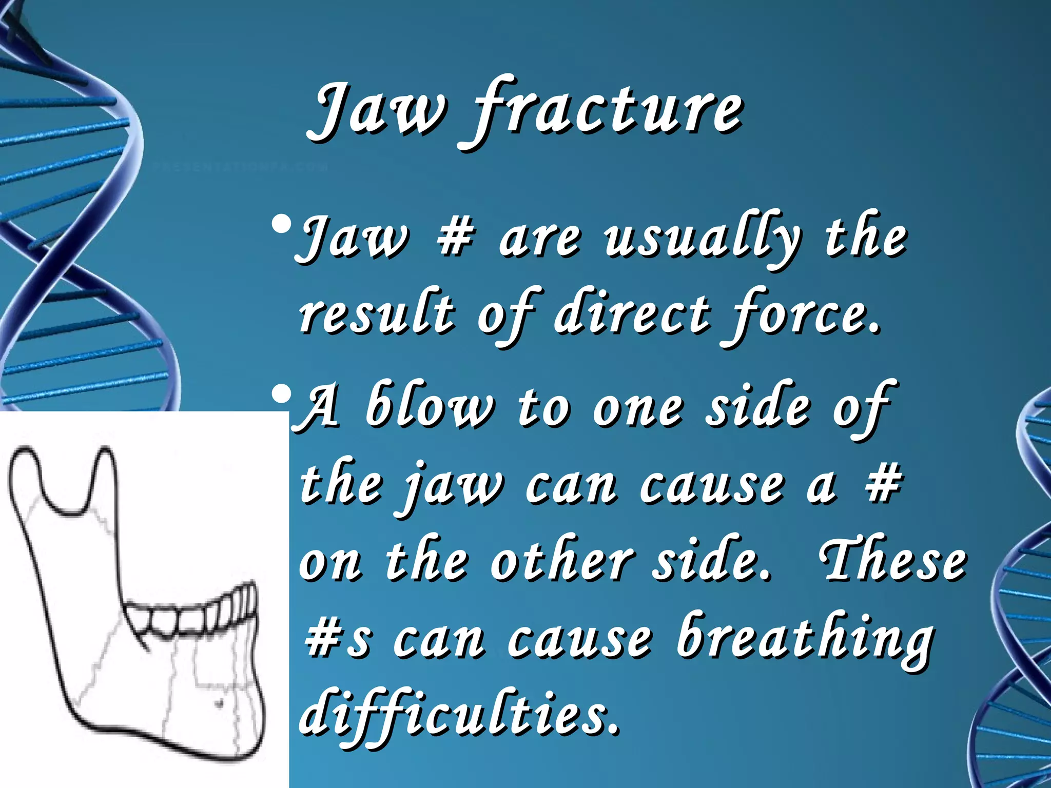 First aid for fracture | PPT