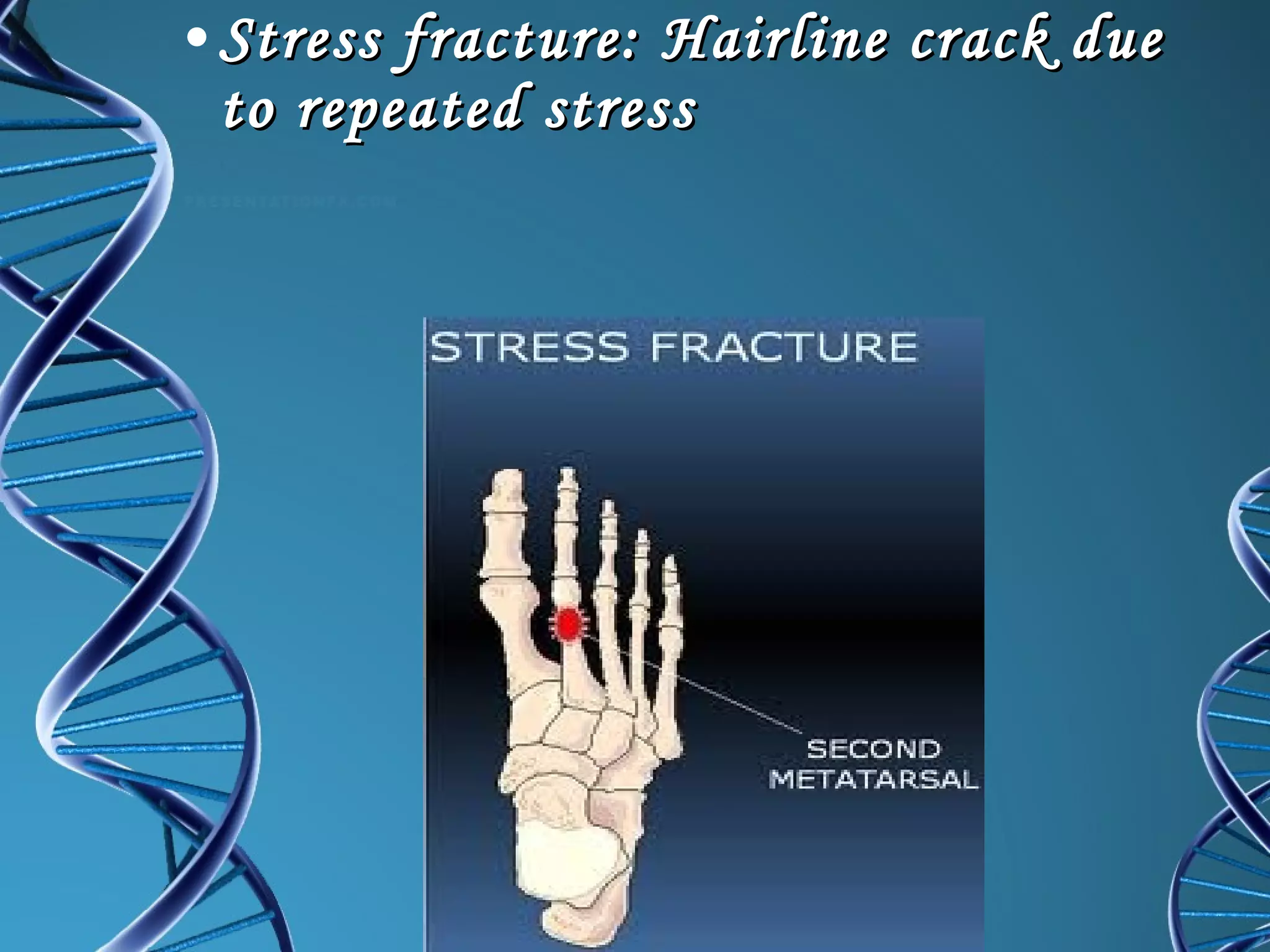 First aid for fracture | PPT