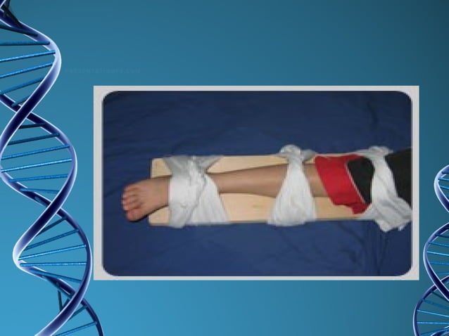 First aid for fracture | PPT