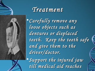 First aid for fracture | PPT