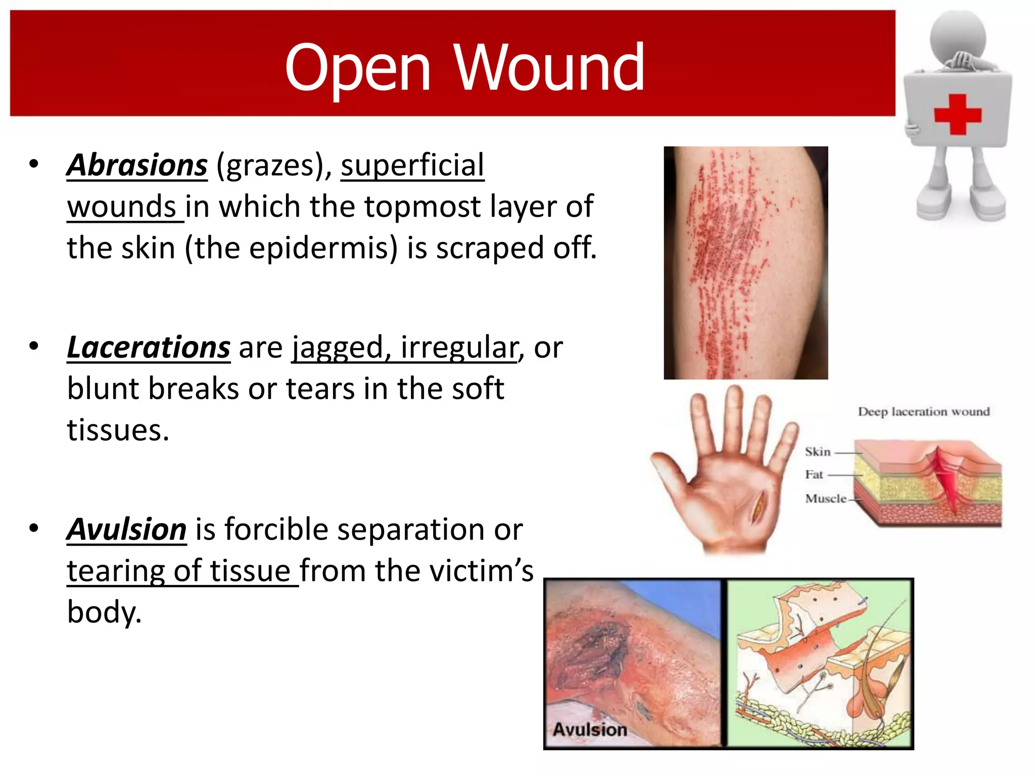 First aid & bandaging | PDF