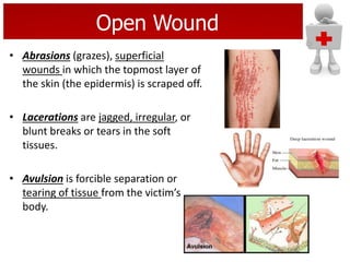 First Aid bandaging slideshow | PDF