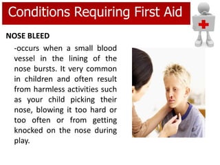 First Aid bandaging slideshow | PDF