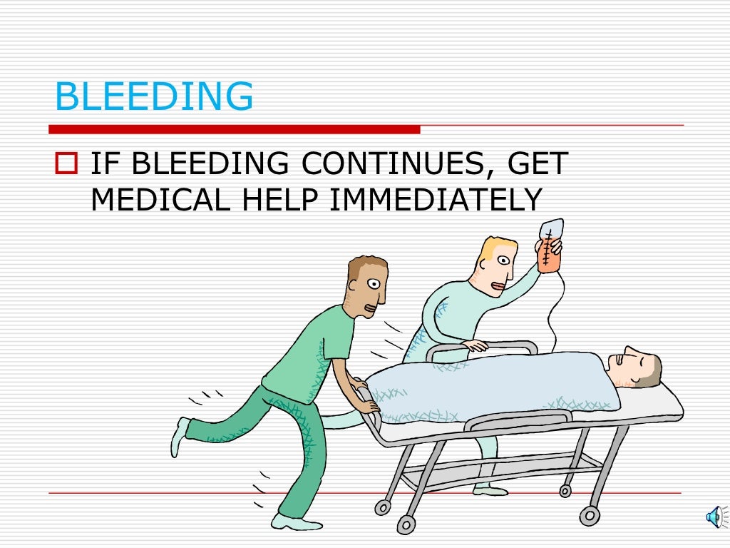 First aid bleeding 2012