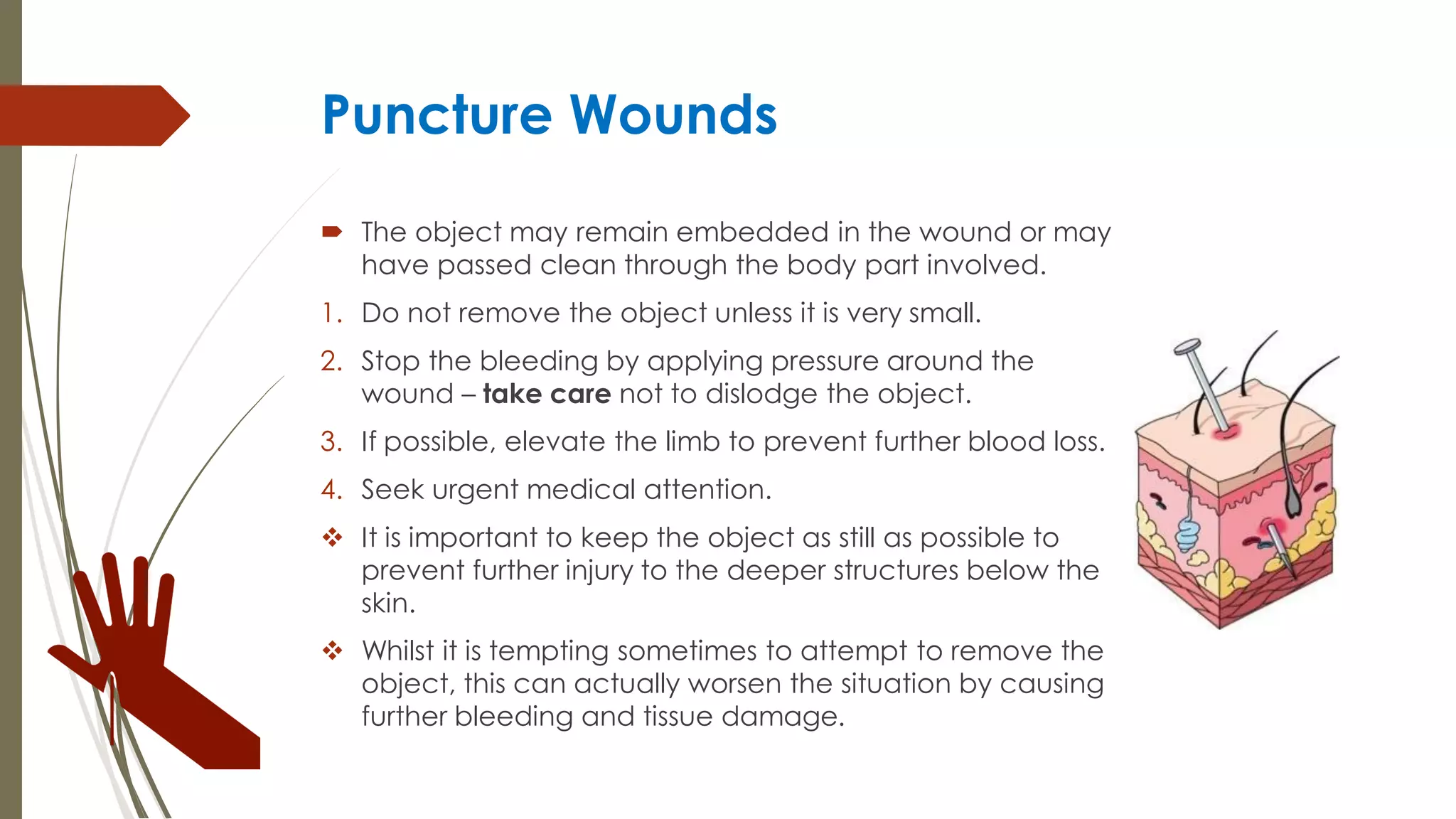 First Aid and Basic Life Support By Essam Sidqi | PDF