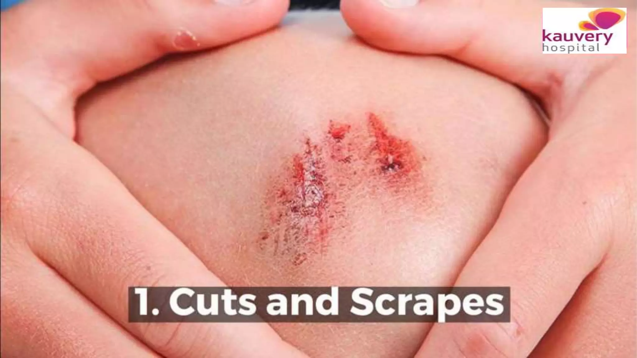 First aid children.pptx