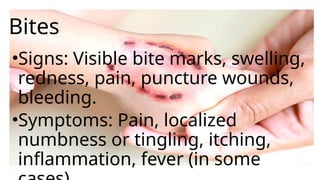 First Aid Concepts, Objectives, and Principles.pptx