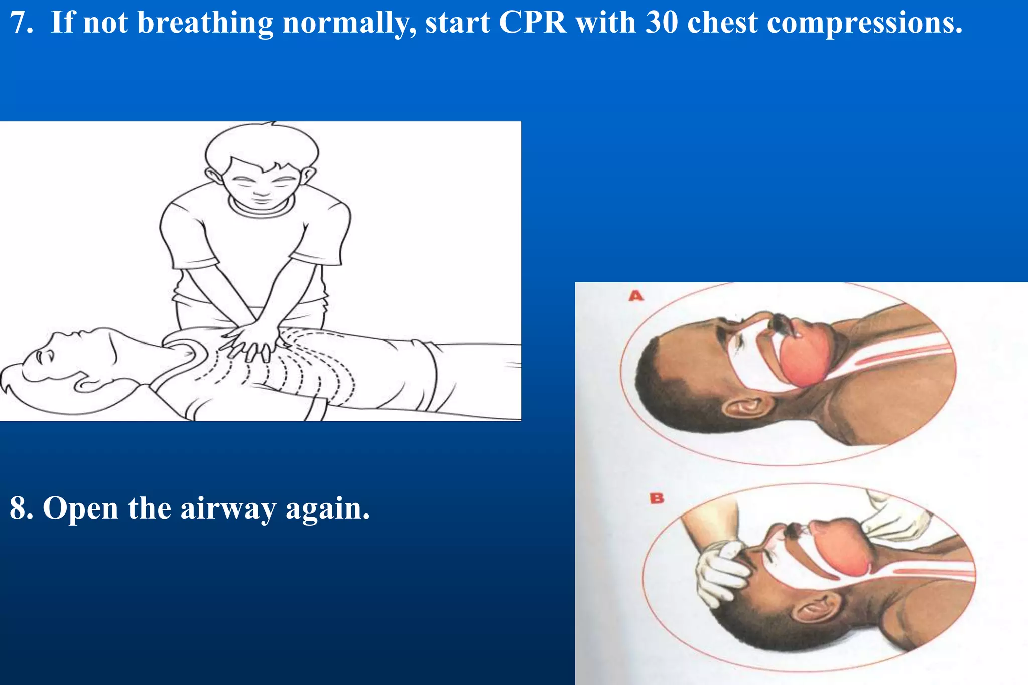 First aid CPR | PPT