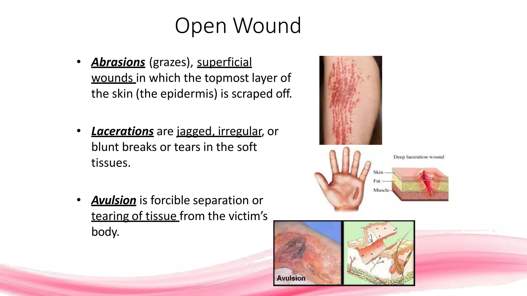 First Aid Demo for COT.pptx