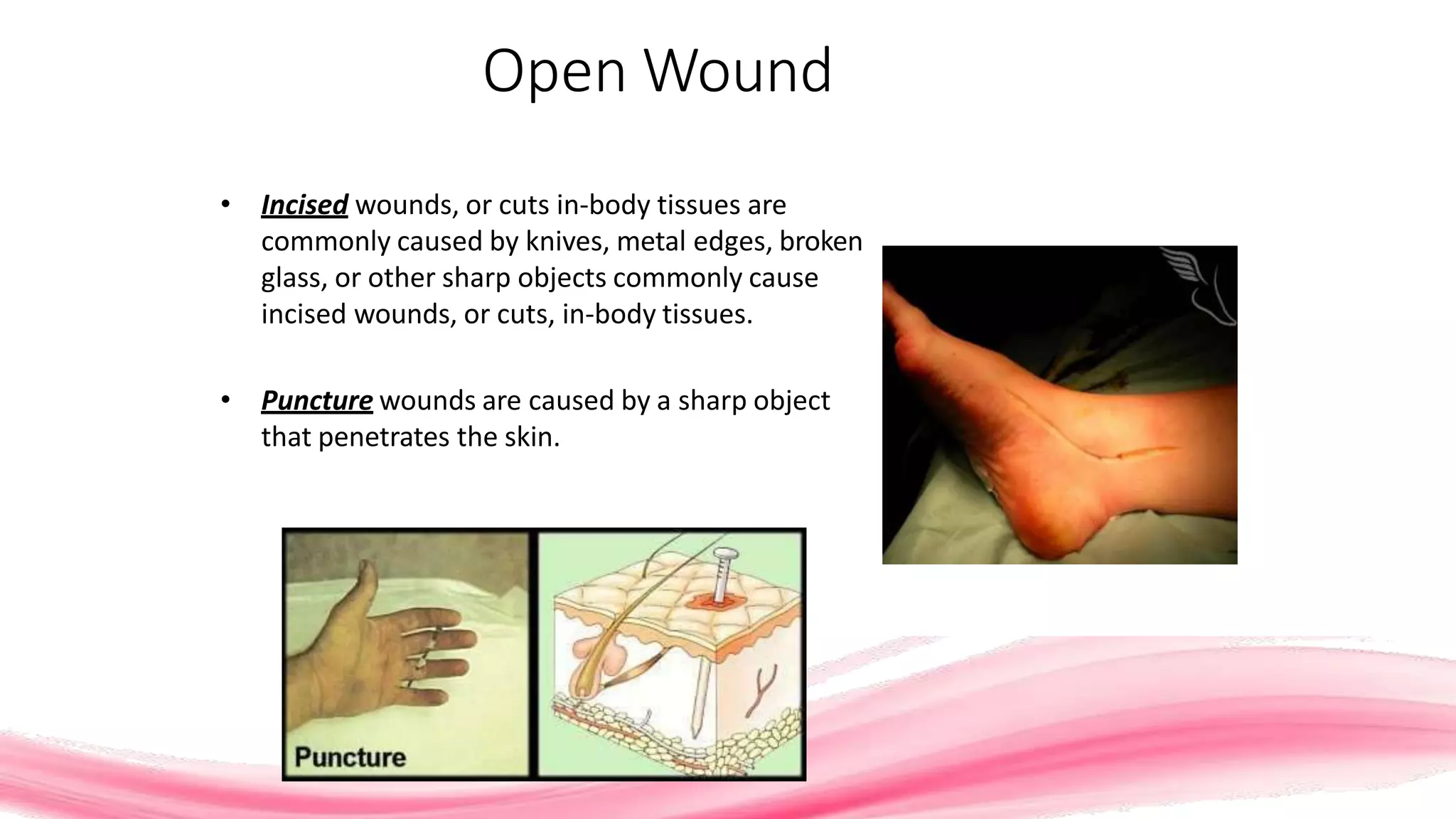 First Aid Demo for COT.pptx