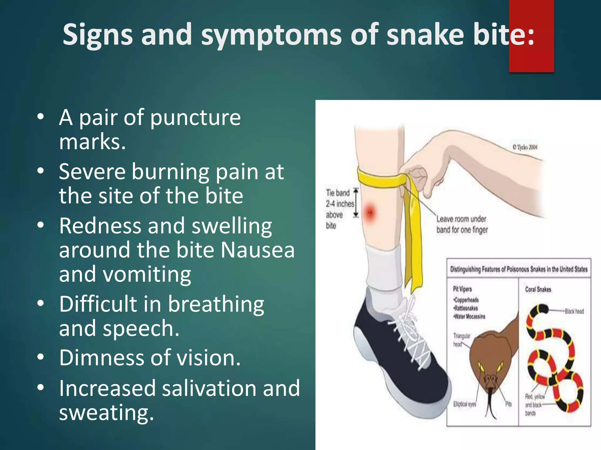 FIRST AID EMERGENCY IN DIFFERENT BITES AND STINGS.pptx