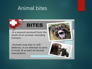 FIRST AID EMERGENCY IN DIFFERENT BITES AND STINGS.pptx