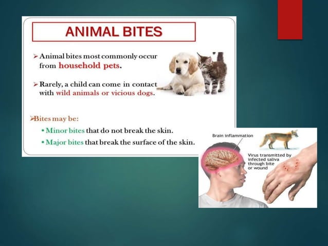 FIRST AID EMERGENCY IN DIFFERENT BITES AND STINGS.pptx