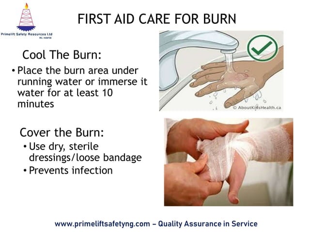 First Aid for Burns.pptx | First Aid | Injuries