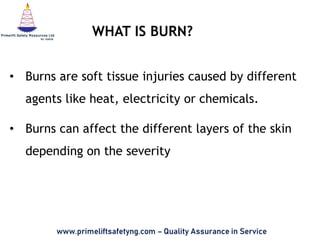 First Aid for Burns.pptx