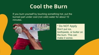First Aid for Kids Basics of AID Safety, Wounds & Burns | PPTX
