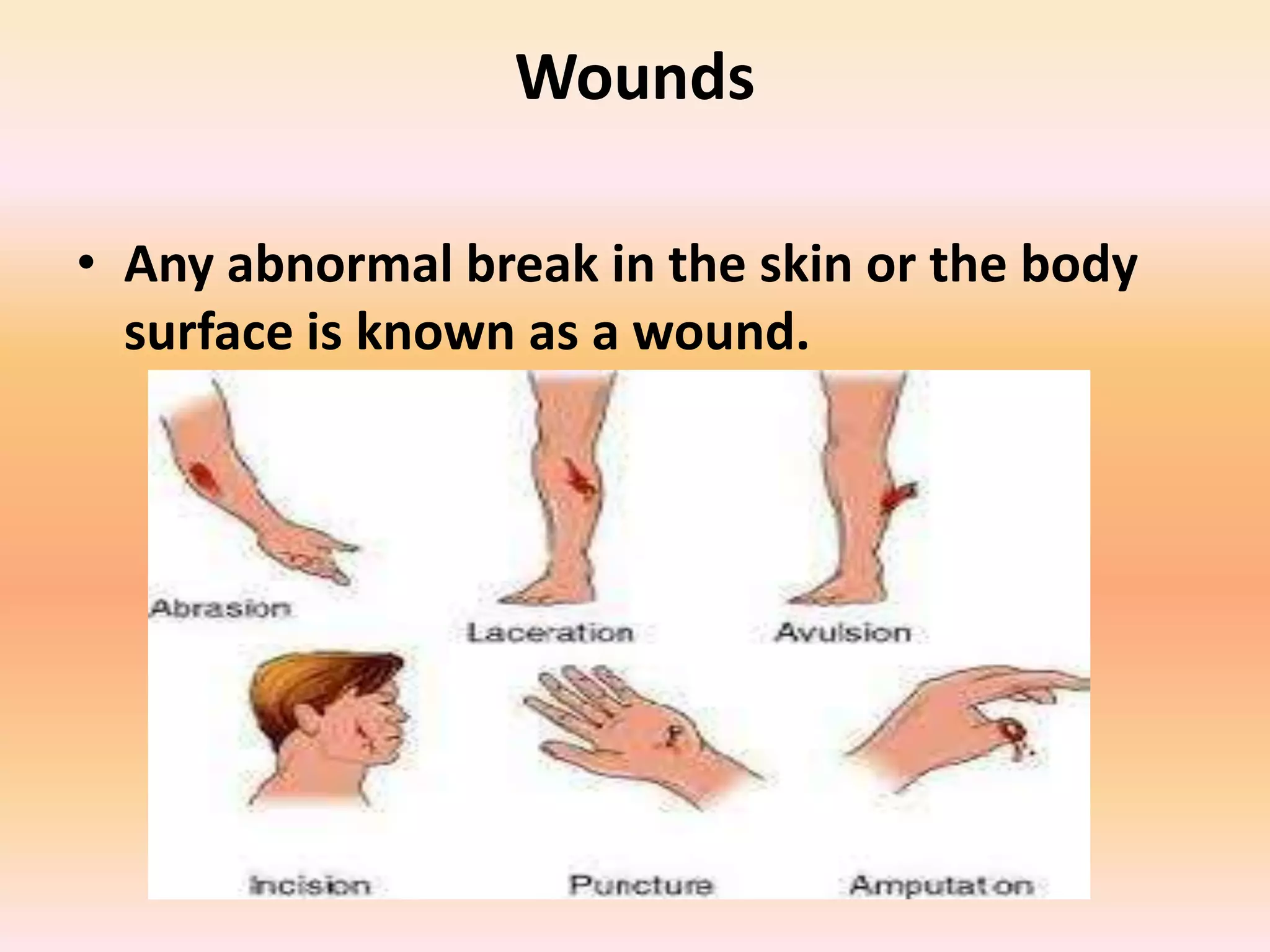 First aid for patients with Wound, Hemorrhage.pptx
