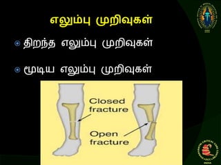 First aid for rta, common accidents | PPT