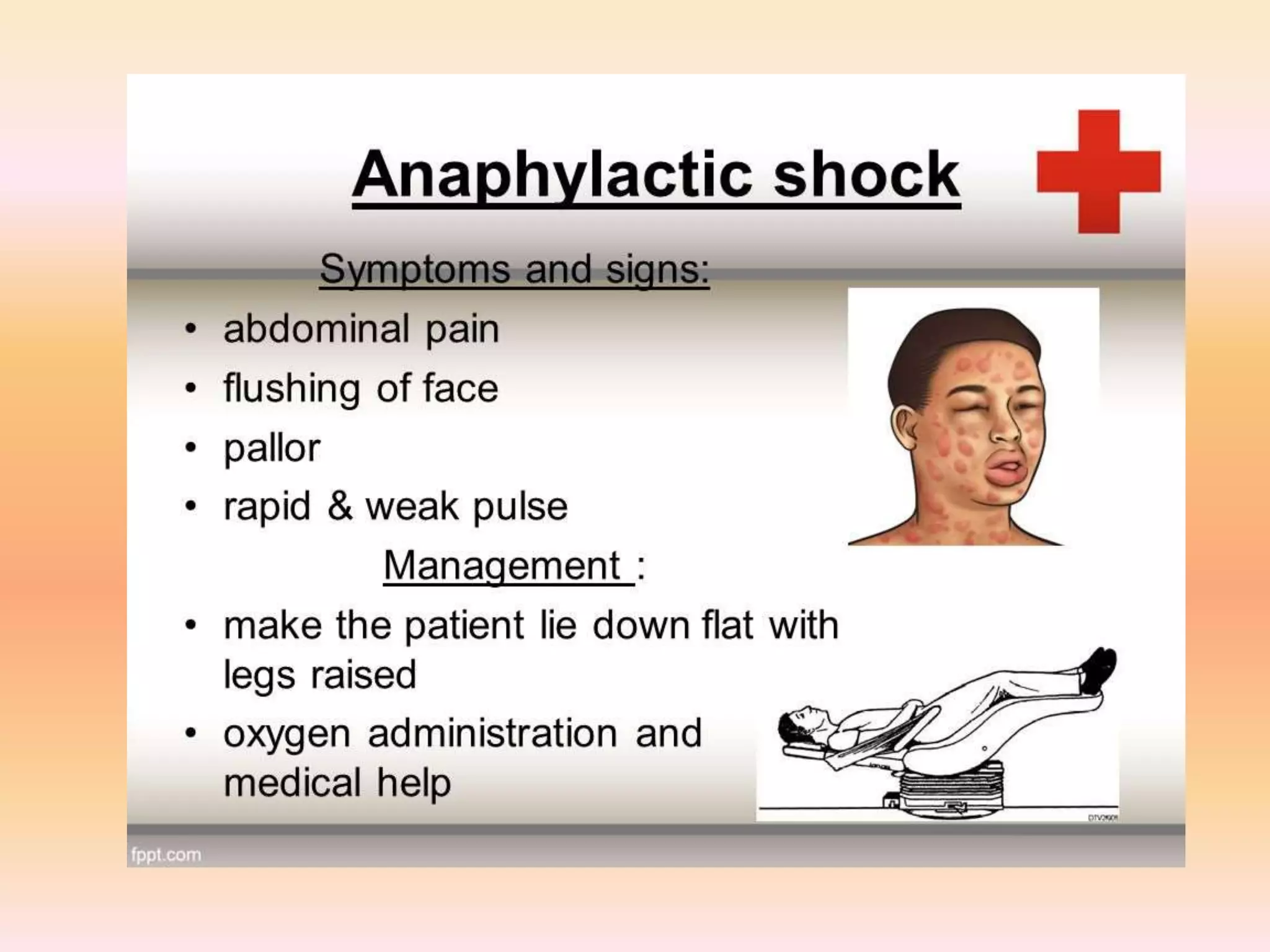first Aid for Stroke and Shock.pptx
