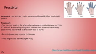 First Aid Guide Presentation Buffalo Grove HS Health 2021 | PPTX