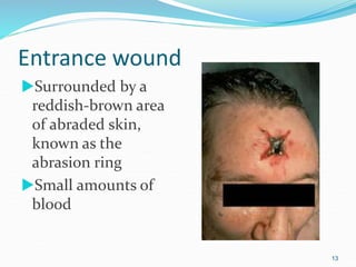 First Aid gunshot wound.power point presentation | PPT
