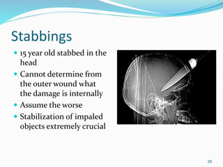 First Aid gunshot wound.power point presentation | PPT