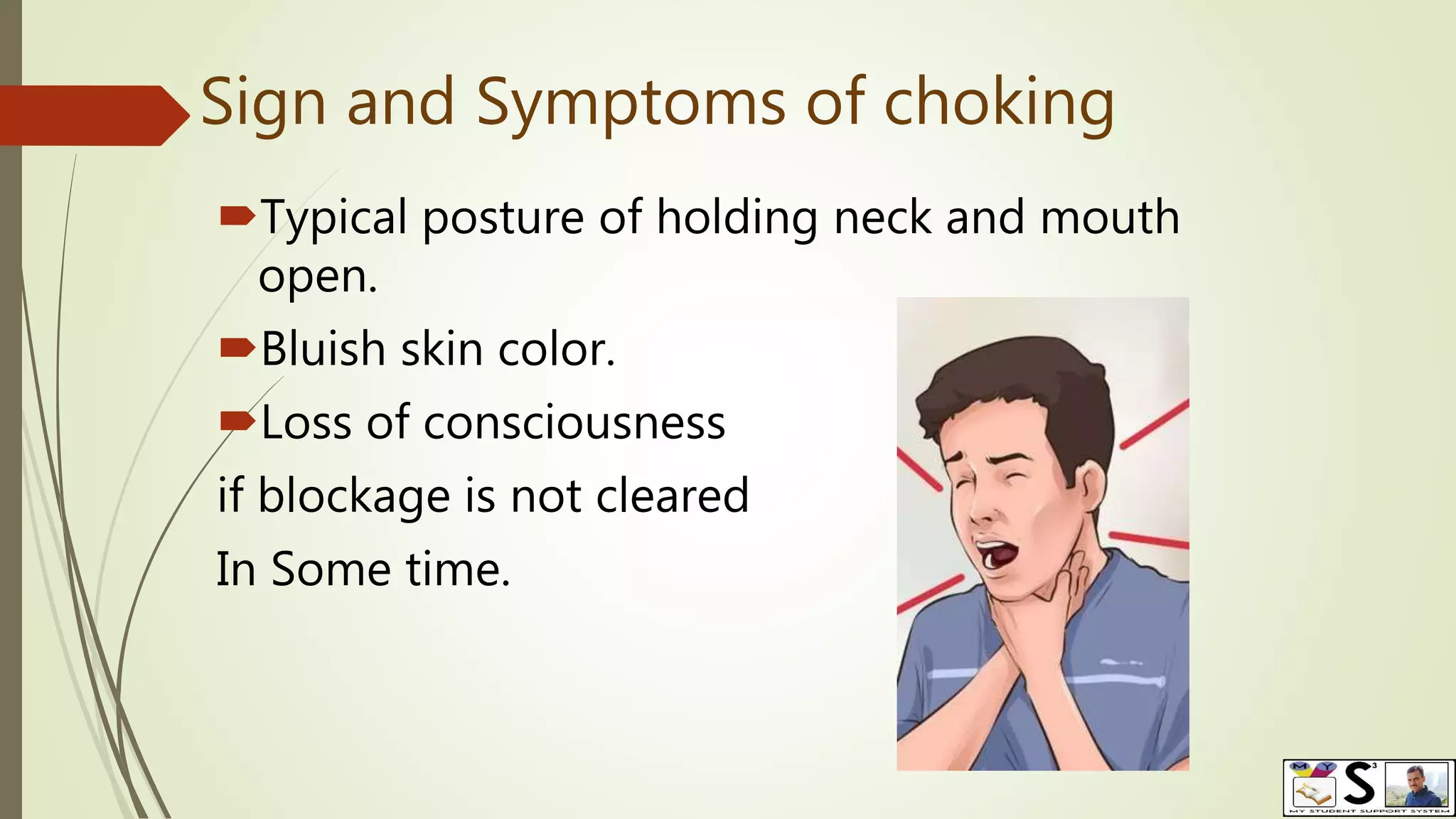 First aid in chocking in ENGLISH | PPTX
