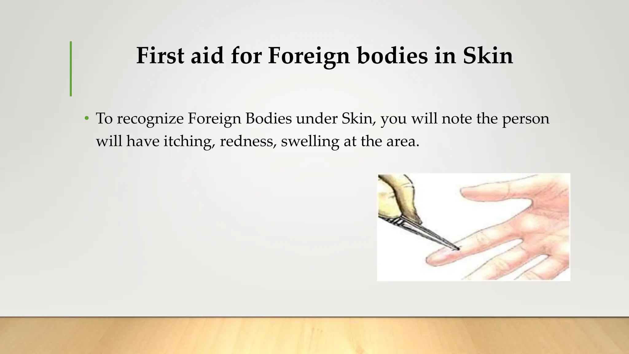 First aid in Foreign bodies Skin, Eye, Ear Nose Throat.pptx