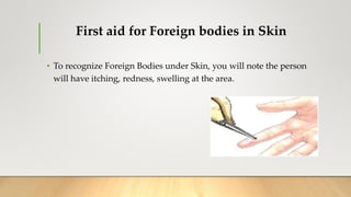 First aid in Foreign bodies Skin, Eye, Ear Nose Throat.pptx