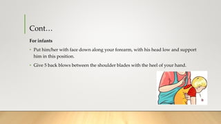 First aid in Foreign bodies Skin, Eye, Ear Nose Throat.pptx