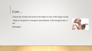 First aid in Foreign bodies Skin, Eye, Ear Nose Throat.pptx