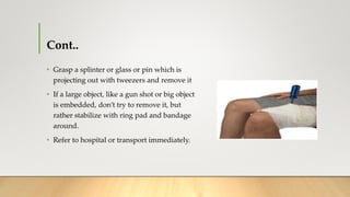 First aid in Foreign bodies Skin, Eye, Ear Nose Throat.pptx