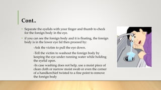 First aid in Foreign bodies Skin, Eye, Ear Nose Throat.pptx