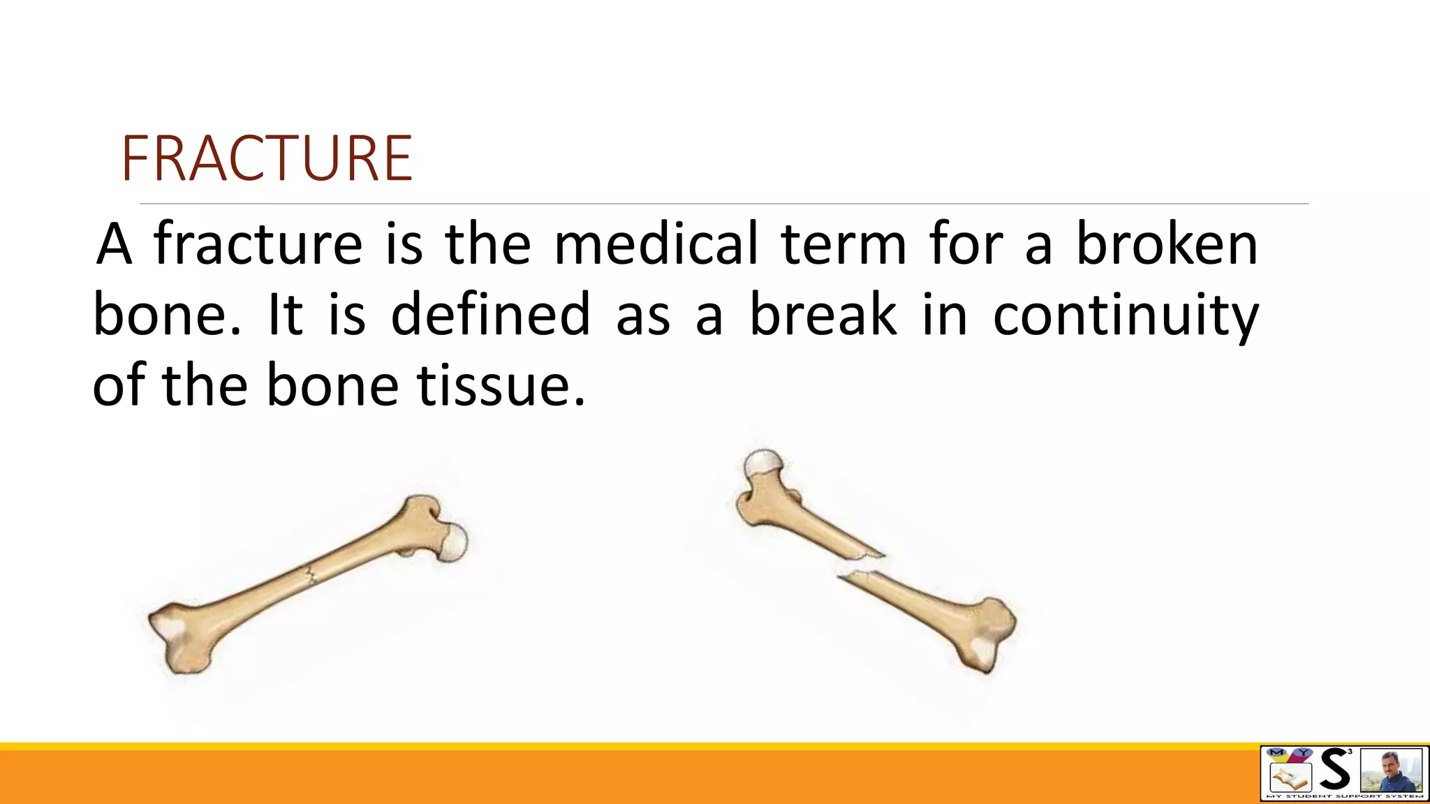 First aid in fracture in ENGLISH | PPTX | First Aid | Injuries