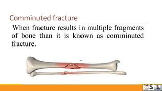First aid in fracture in ENGLISH | PPTX