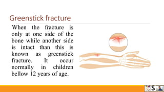 First aid in fracture in ENGLISH | PPTX