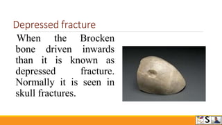 First aid in fracture in ENGLISH | PPTX