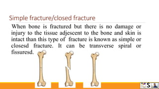 First aid in fracture in ENGLISH | PPTX