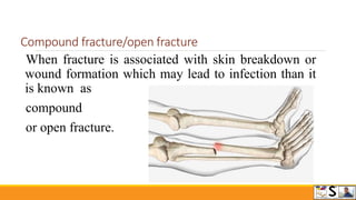 First aid in fracture in ENGLISH | PPTX