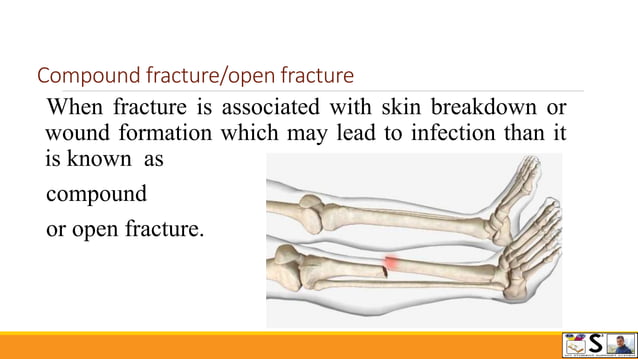 First aid in fracture in ENGLISH | PPTX | First Aid | Injuries