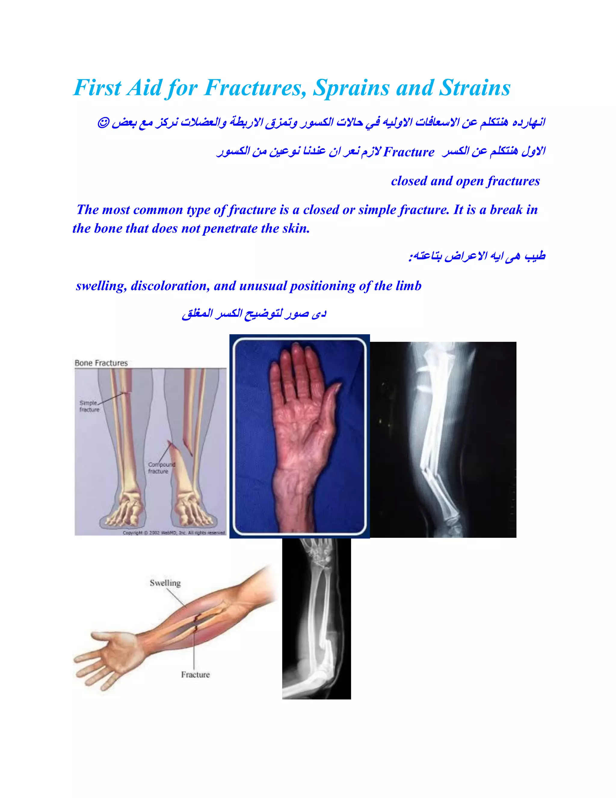 First aid in fracture , sprain and srtain | PDF