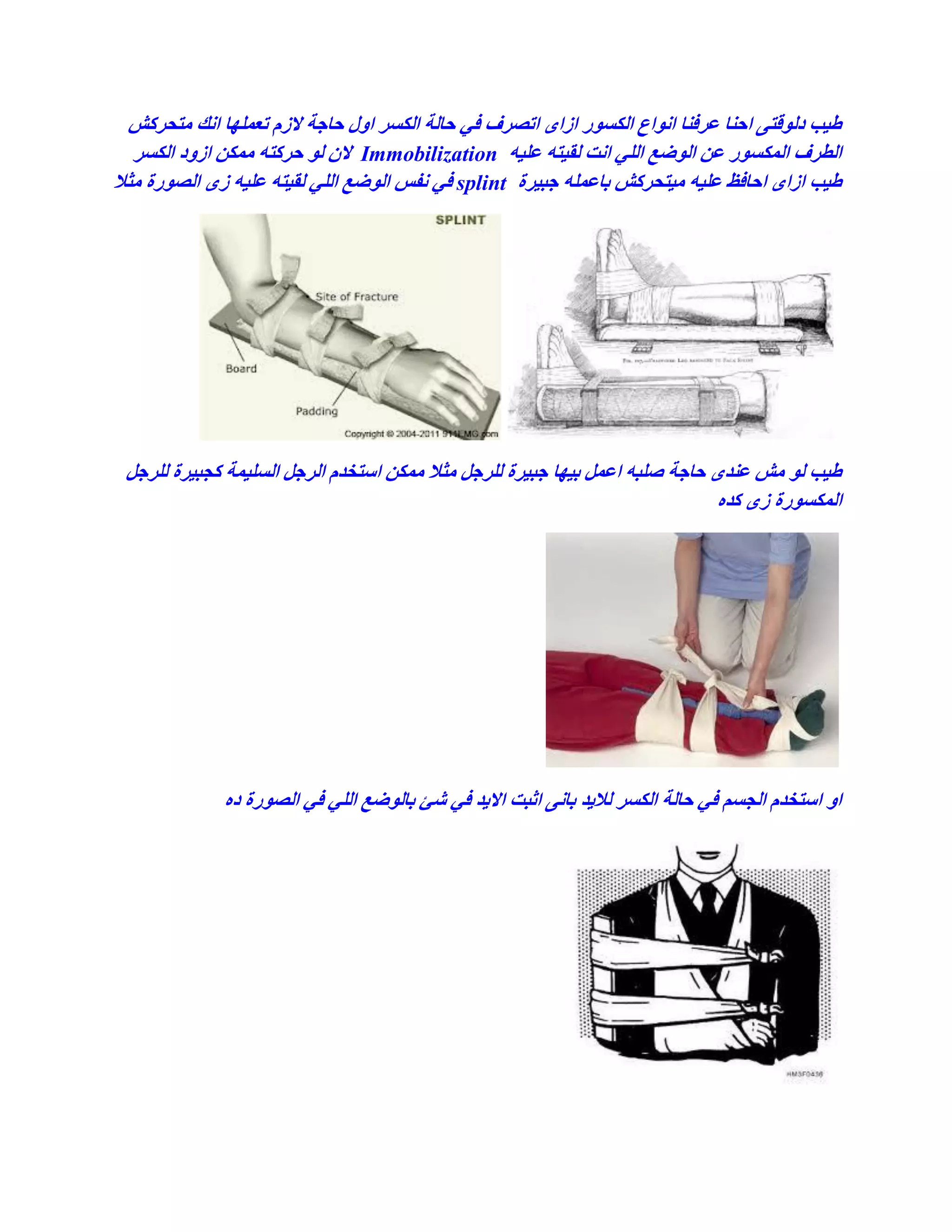 First aid in fracture , sprain and srtain | PDF