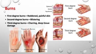 First aid in industry | PPTX