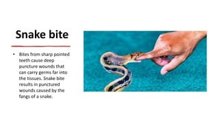 First Aid in Sting and Bites or snake bite | PPTX