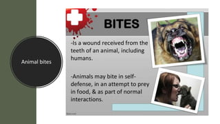 First Aid in Sting and Bites or snake bite | PPTX
