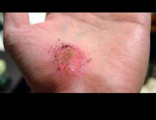 FIRST AID IN WOUND MANAGEMENT for learners and for everybody training ...