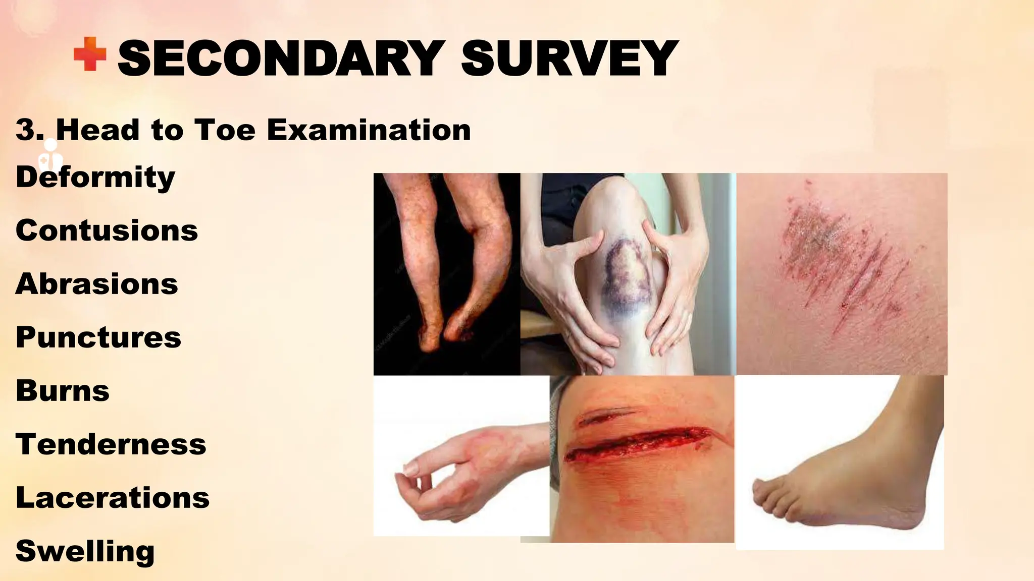 First Aid Lesson.pptx